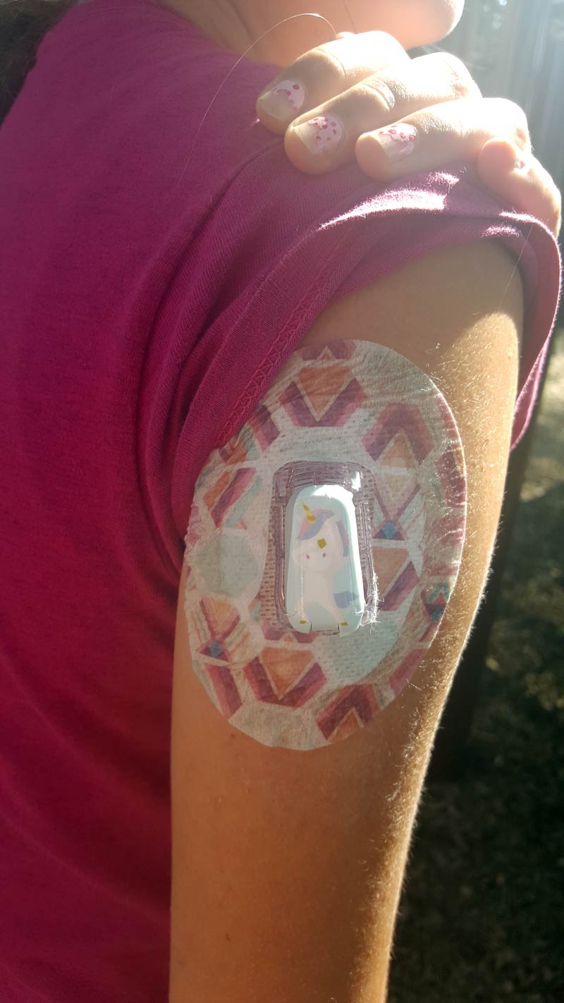 Confidence & Fun with Pump Peelz CGM Medical Tape CGM Stickers - Akron ...