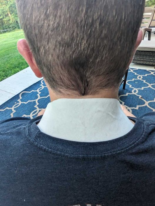 Pain-Free Summer with Salonpas: The World's #1 Best-Selling Patch ...